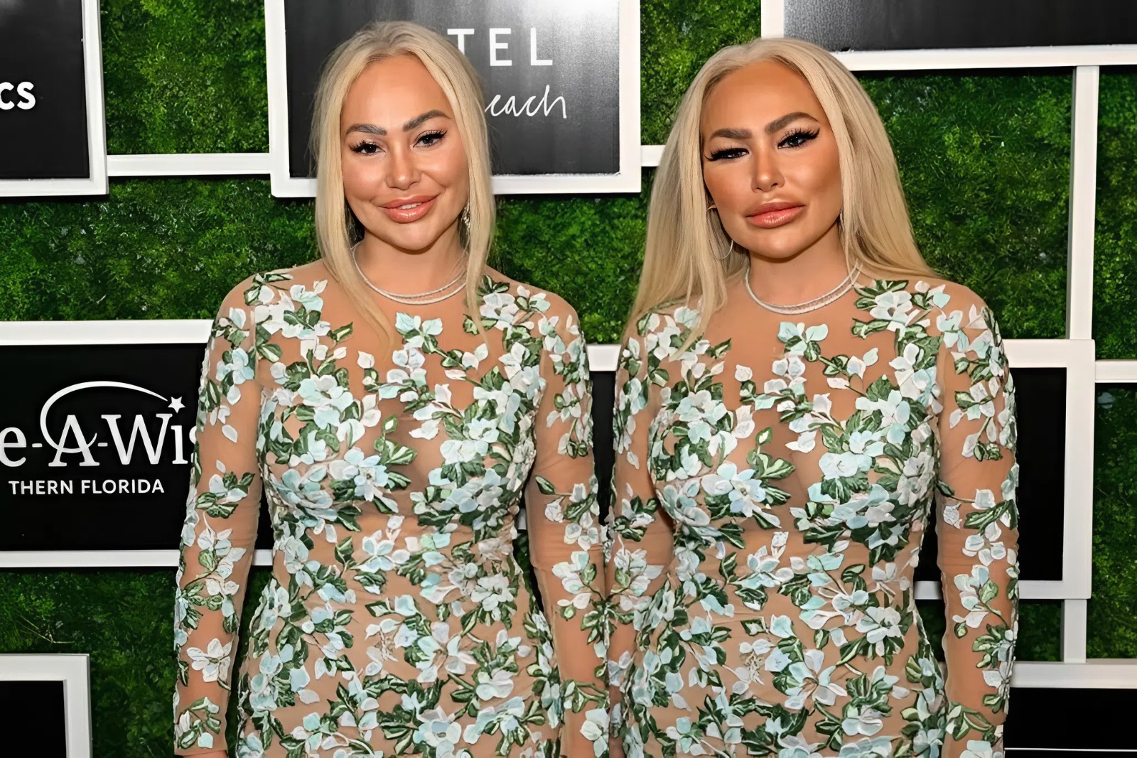 Fans Fear Darcey & Stacey May Be Struggling With Image Dysphoria After ...